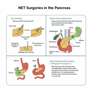 Surgery - NETRF